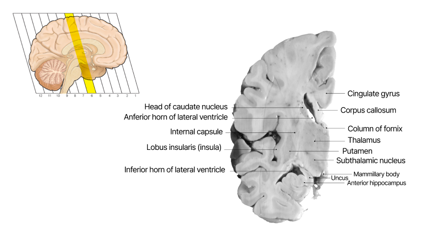 관상면(Coronal Section) - 뇌구조 | 뇌클러스터전문포털(K-Brain Net)